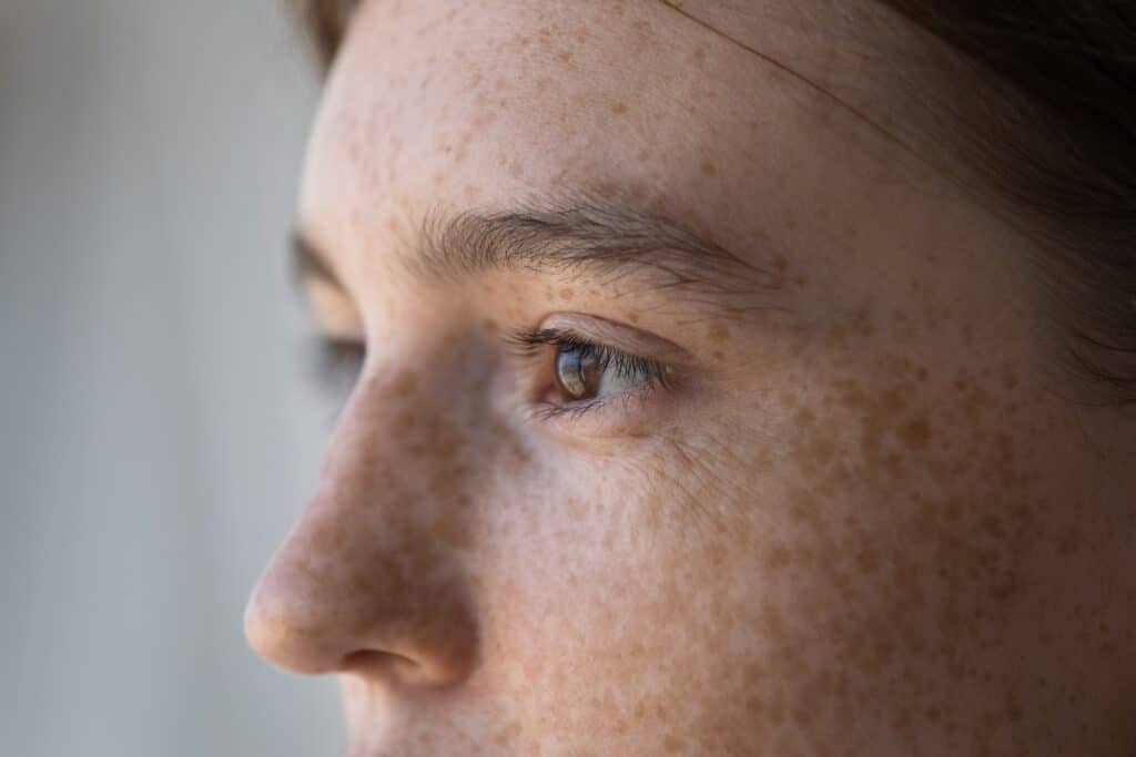 BroadBand Light Therapy: How It Affects the Skin